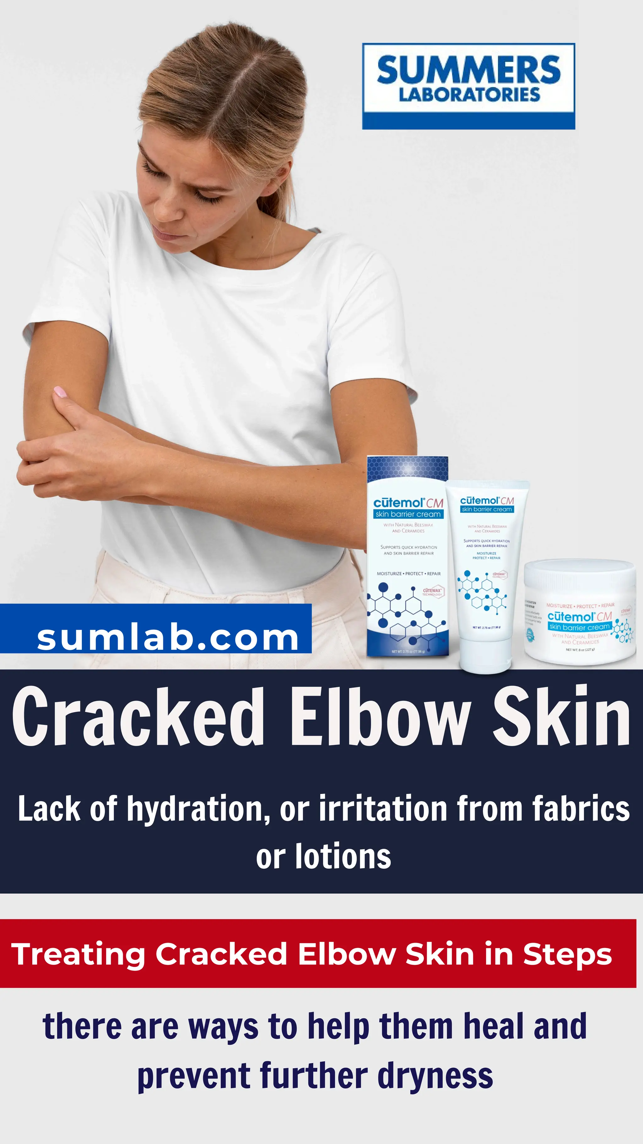 Why does my elbow skin crack and how can I prevent it? | PDF