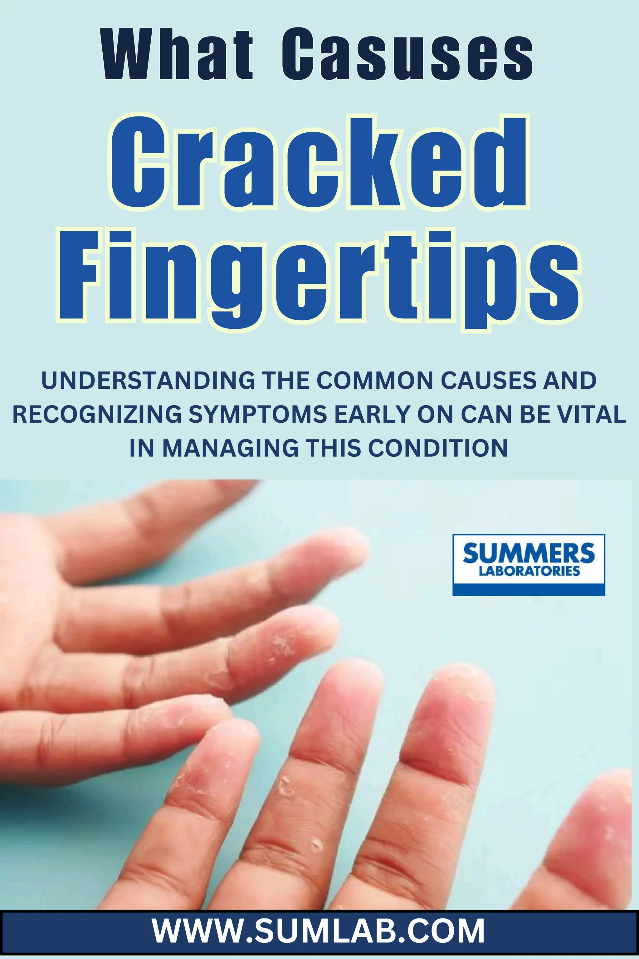 What causes cracked fingertips and how can I prevent them? | PDF