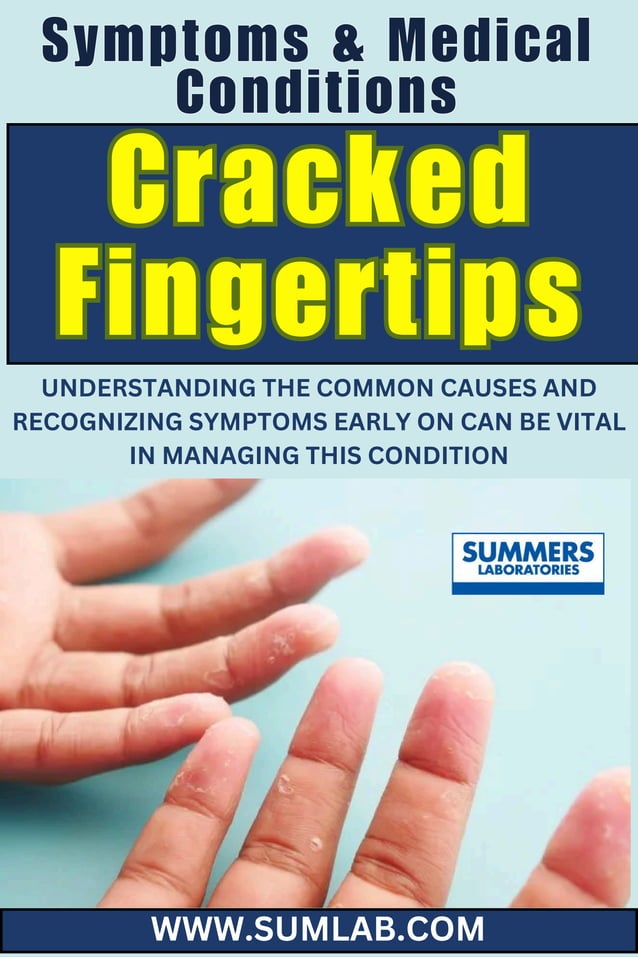 What deficiency causes cracked fingertips? | PDF