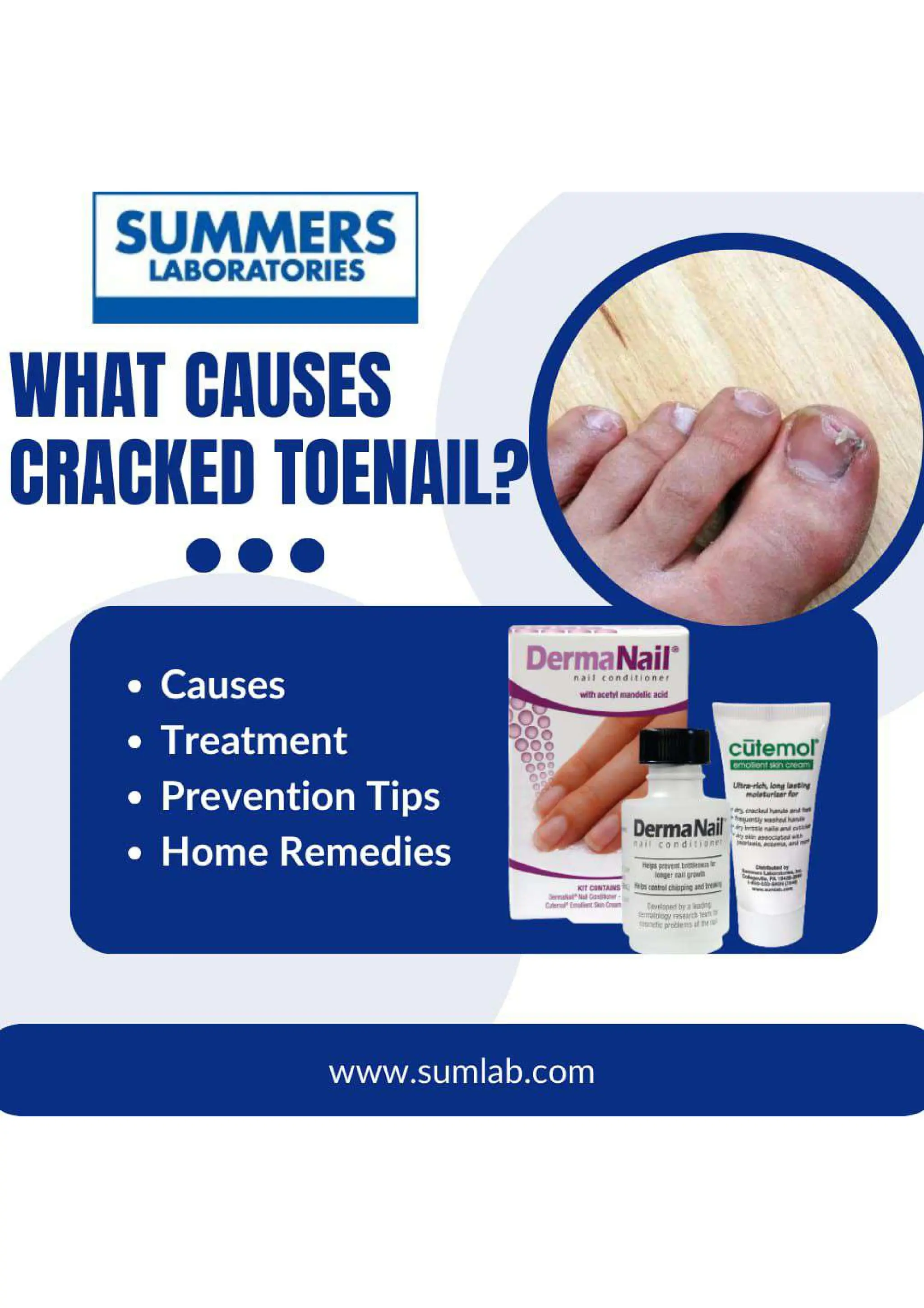 What causes a toenail to crack? How to fix a cracked toenail at home? | PDF