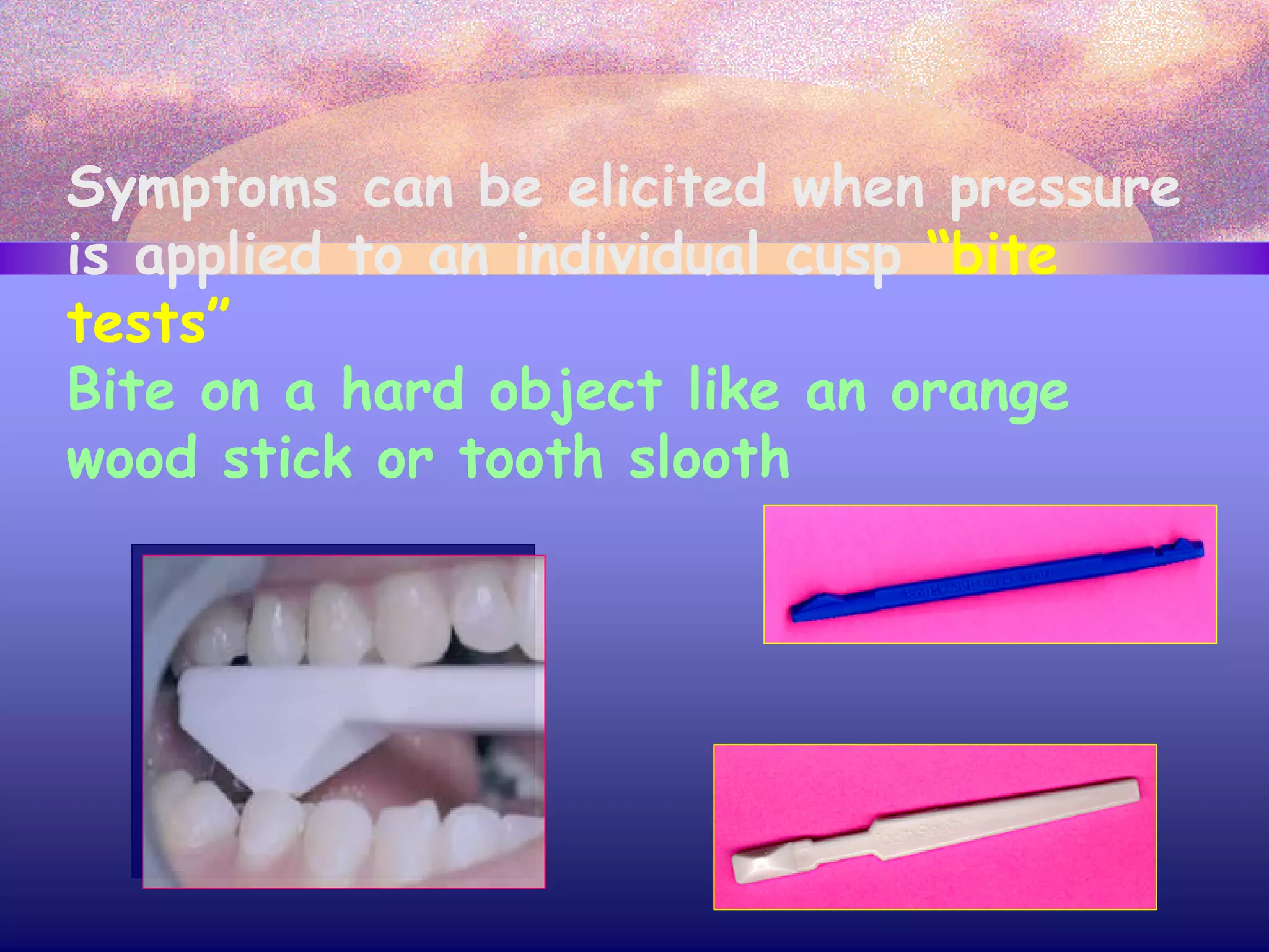 Cracked Tooth Syndrome.pdf