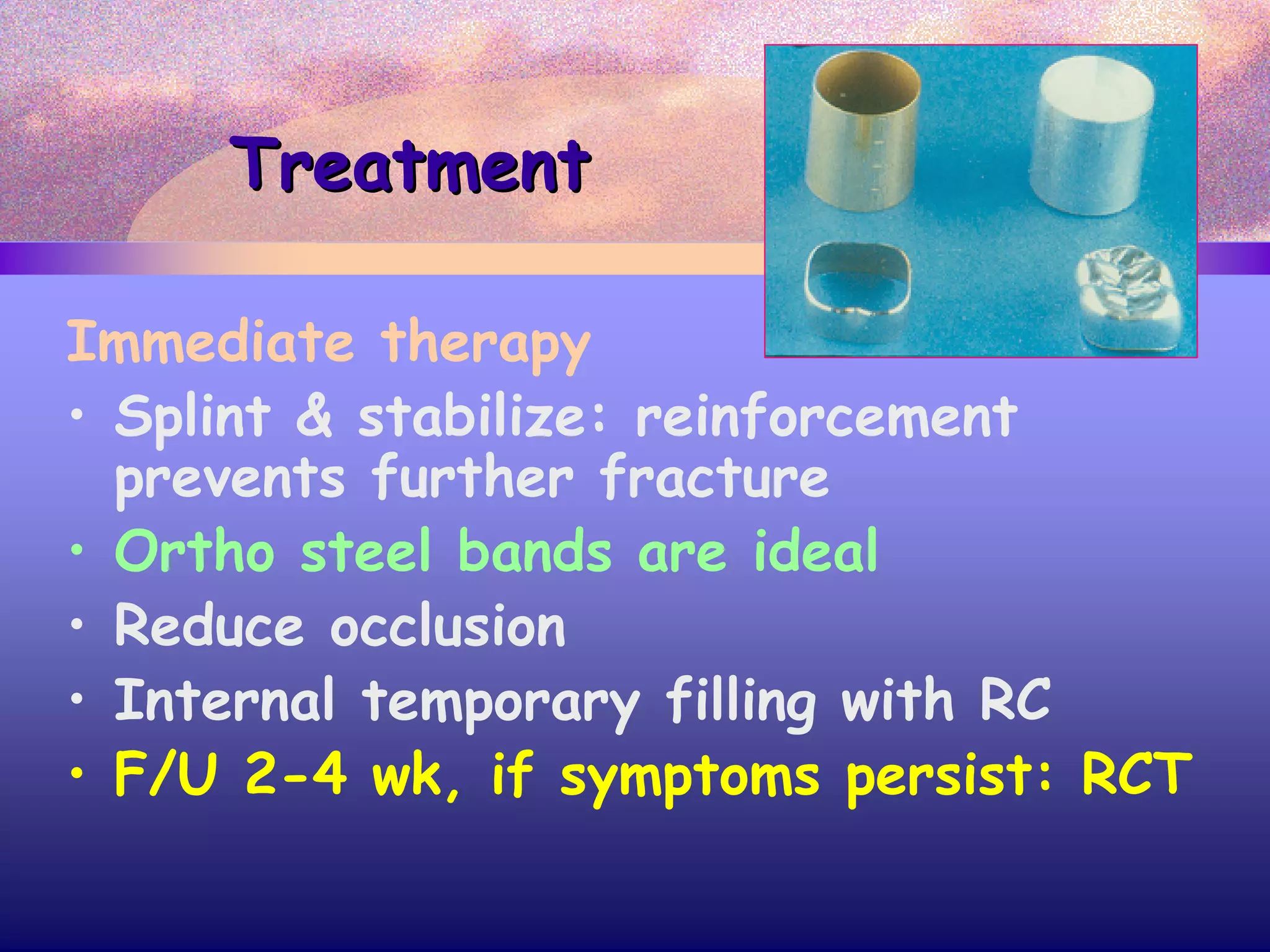 Cracked Tooth Syndrome.pdf