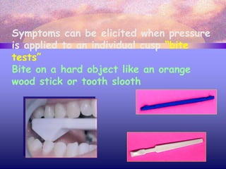 Cracked Tooth Syndrome.pdf