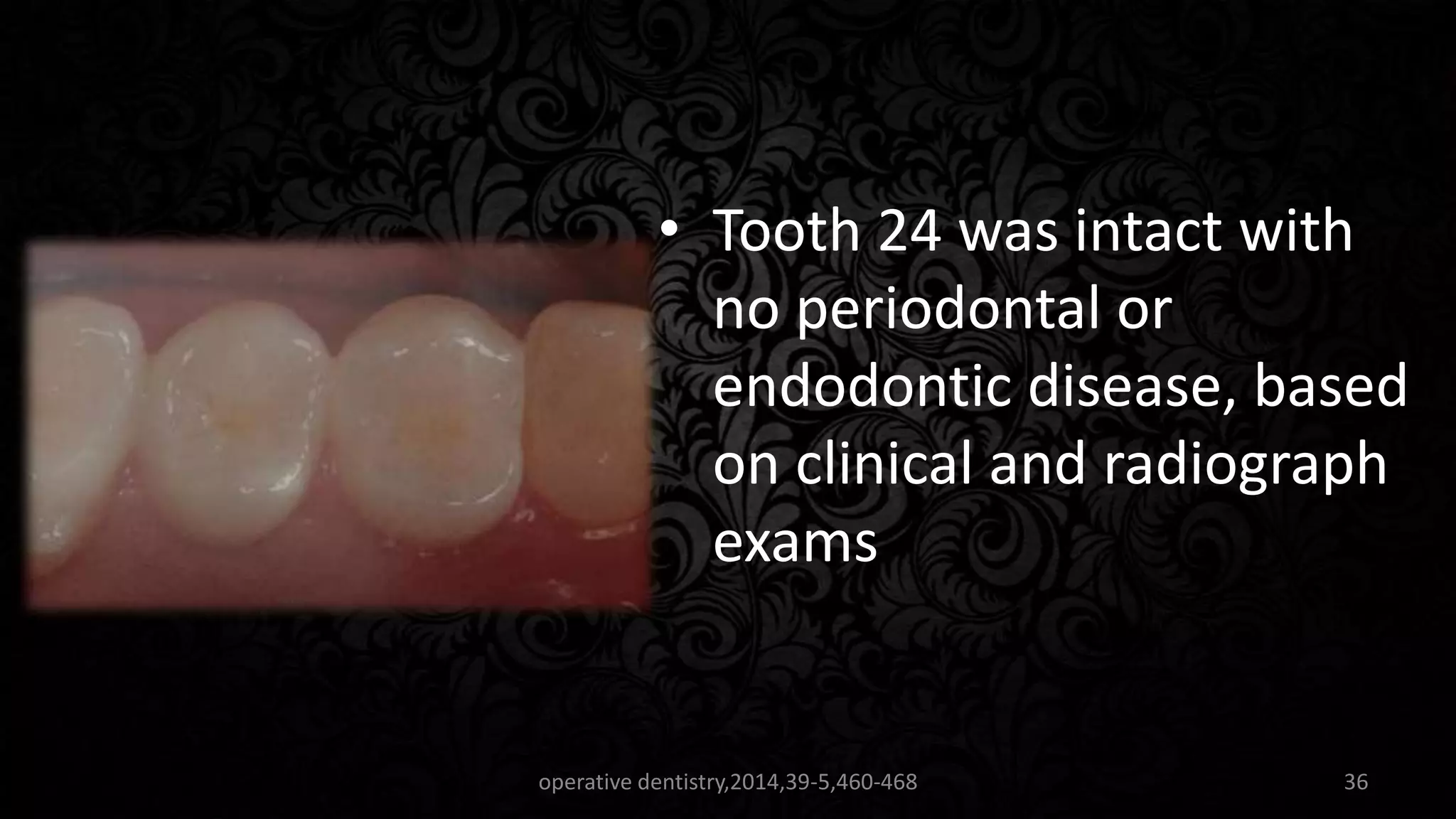 Cracked tooth syndrome in an | PPTX