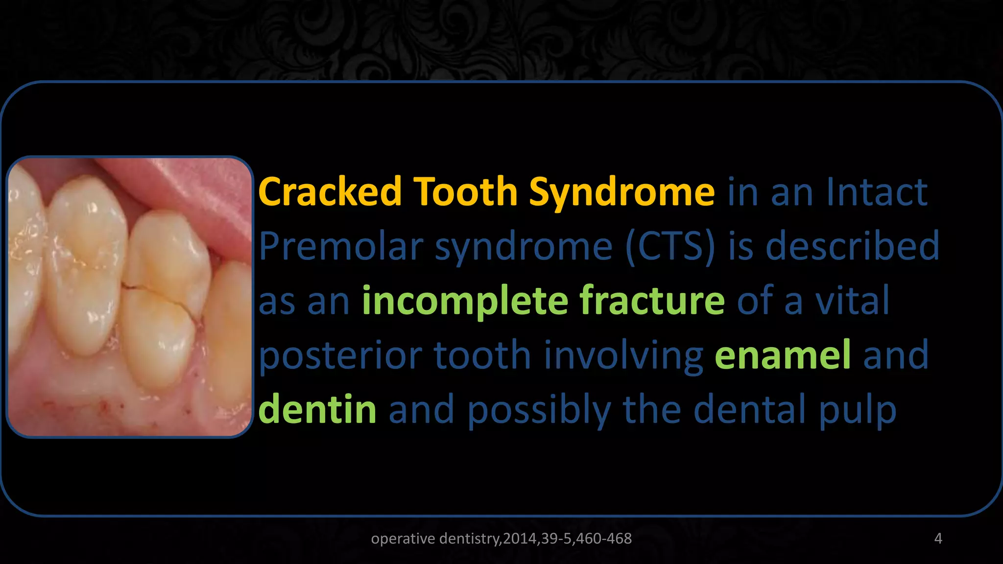Cracked tooth syndrome in an | PPTX