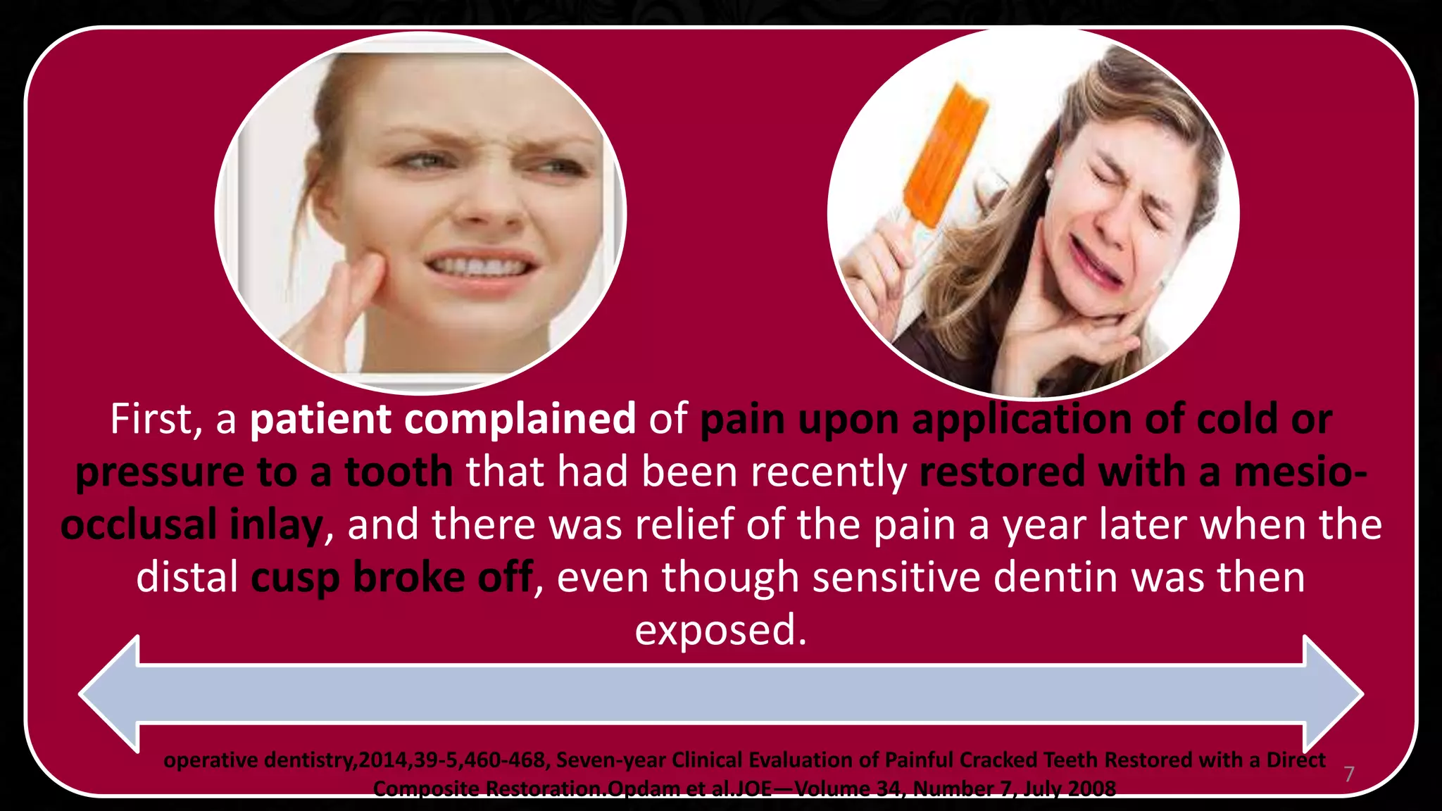 Cracked tooth syndrome in an | PPTX