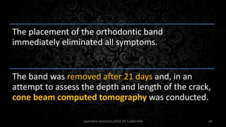 Cracked tooth syndrome in an | PPTX