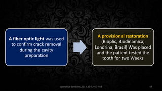Cracked tooth syndrome in an | PPTX