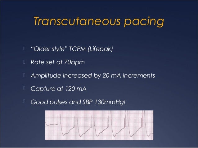 Craig hore on emergency pacing
