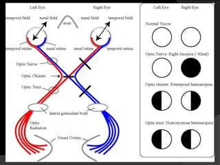 Optic Nerve | PPT