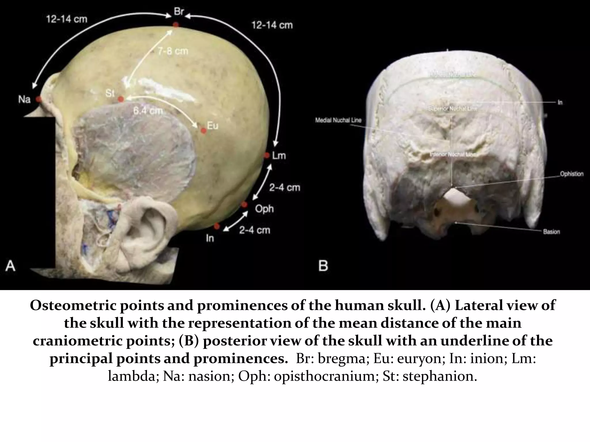 crainometric 2022.pptx