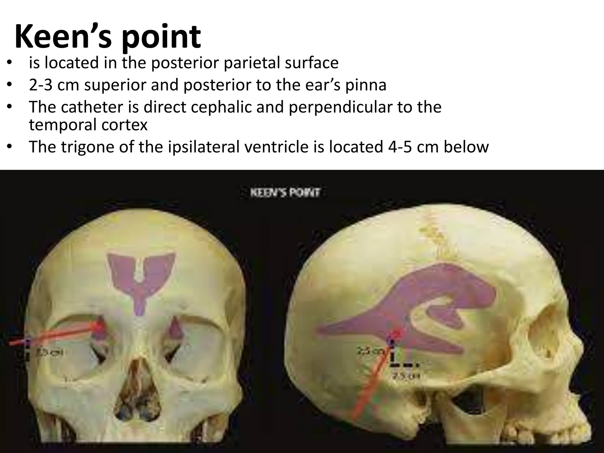 crainometric 2022.pptx