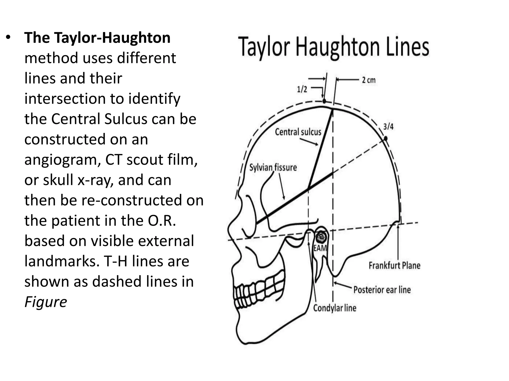 crainometric 2022.pptx