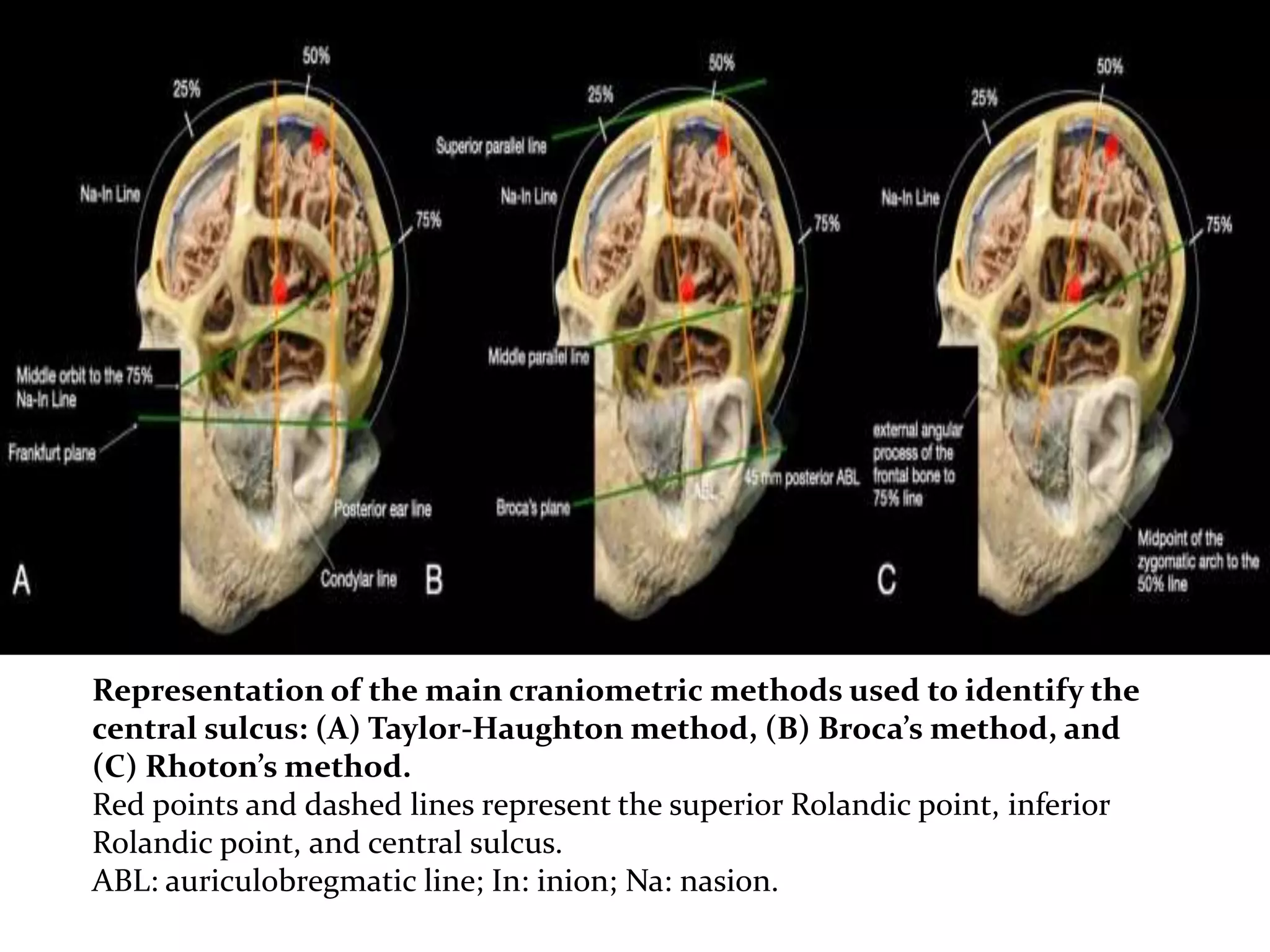 crainometric 2022.pptx