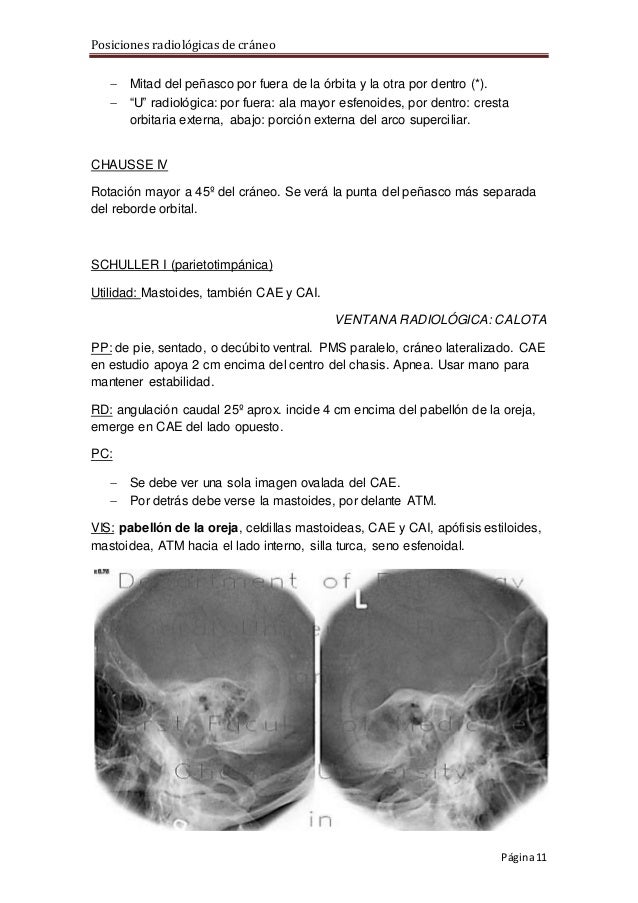 Posiciones radiológicas de cráneo.