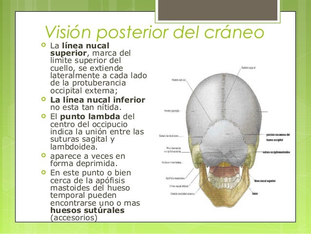 Craneo 3
