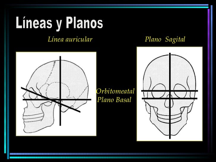 RADIO ANATOMIA CRANEO