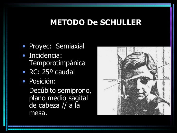 RADIO ANATOMIA CRANEO