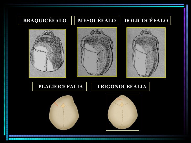 RADIO ANATOMIA CRANEO