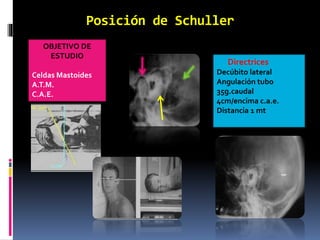 Craneo practica 2015 copia | PPTX