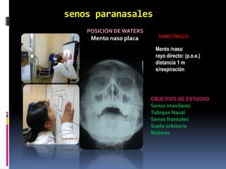 Craneo practica 2015 copia | PPTX