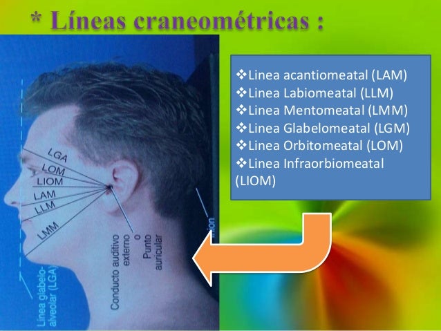 anatomia radiologica de craneo