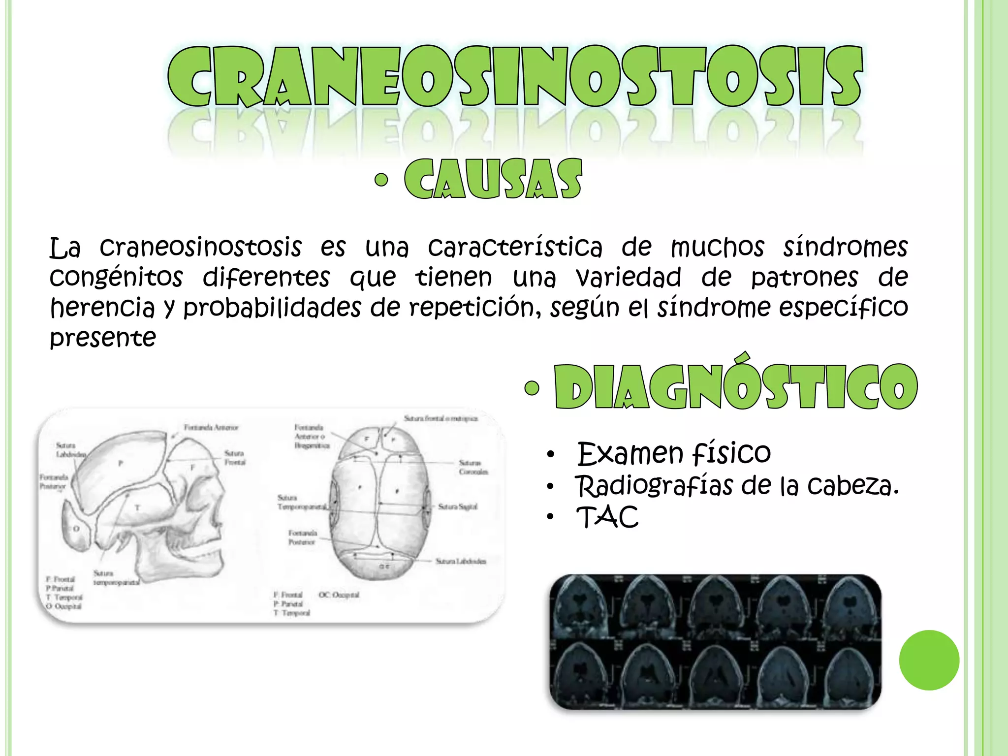 Craneosinostosis | PPTX | Ear, Nose and Throat Conditions | Diseases ...