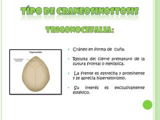 Craneosinostosis | PPTX