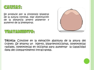 Craneosinostosis | PPTX
