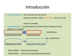 Craneosinostosis No Sindromicas | PPT