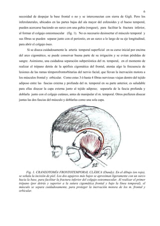 Craneotomias | PDF