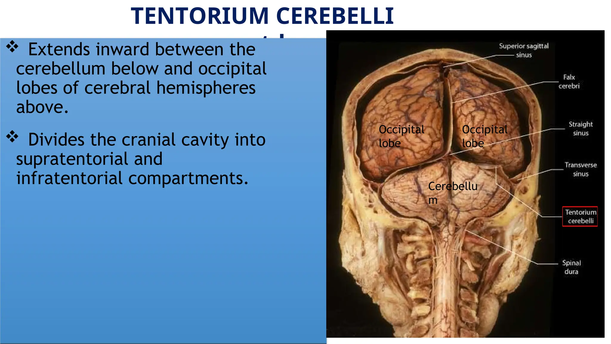 Anatomy of the CRANIAL-CAVITY-I in human.ppt