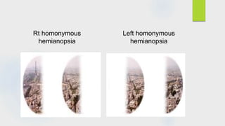 Cranial nerve-examination.ppt