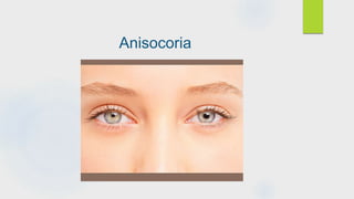 Cranial nerve-examination.ppt