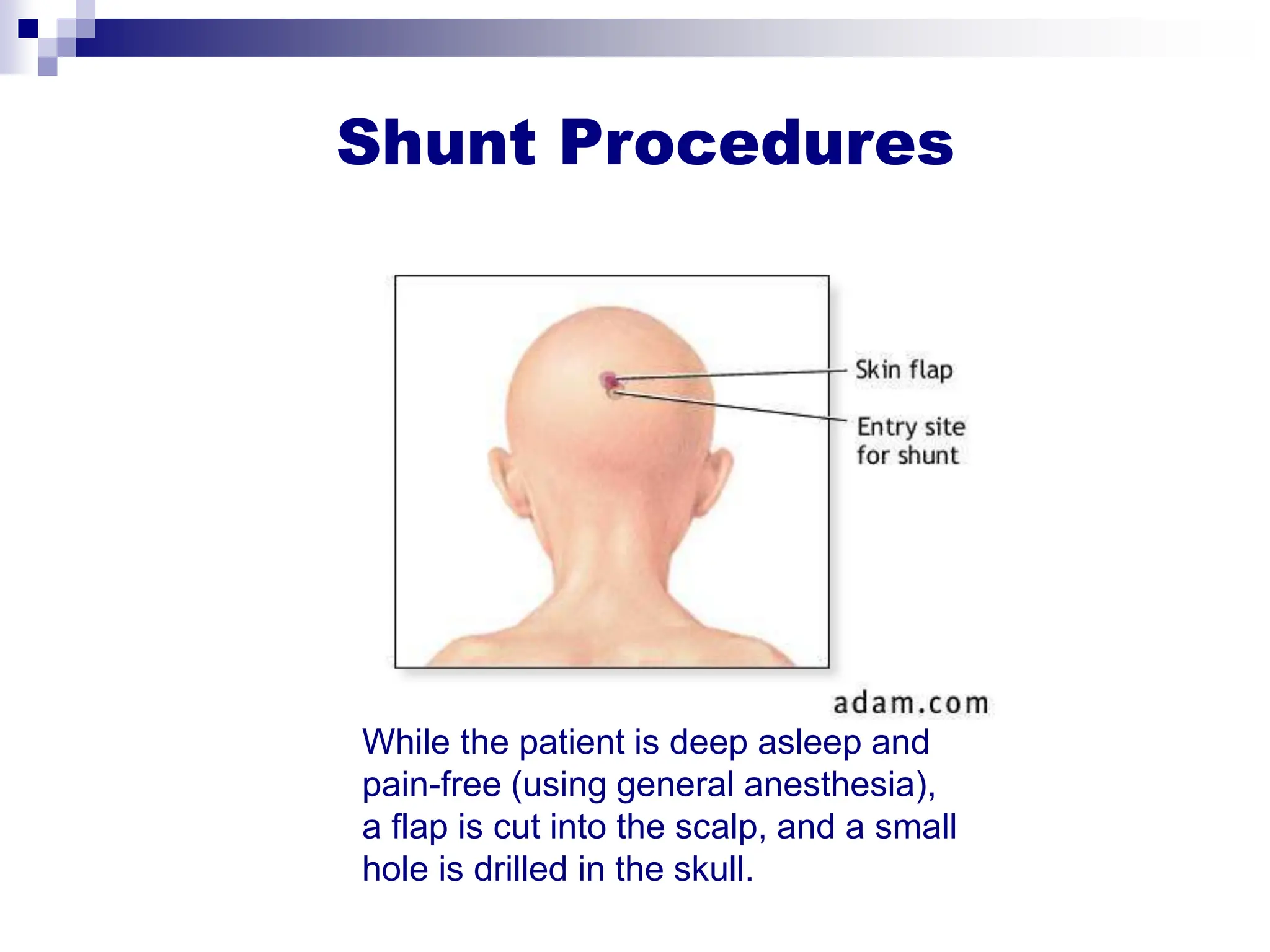 Head-intracranial-surgery-care-nursing.ppt
