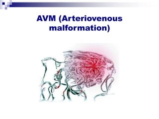 Head-intracranial-surgery-care-nursing.ppt
