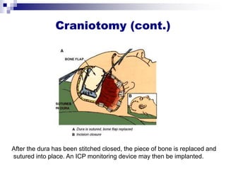 Head-intracranial-surgery-care-nursing.ppt