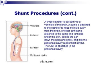 Head-intracranial-surgery-care-nursing.ppt