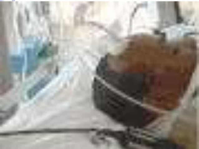 Head-intracranial-surgery-care-nursing.ppt