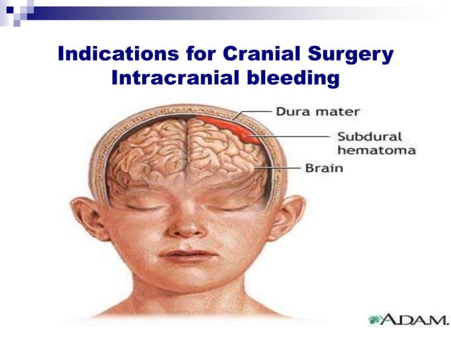 Head-intracranial-surgery-care-nursing.ppt