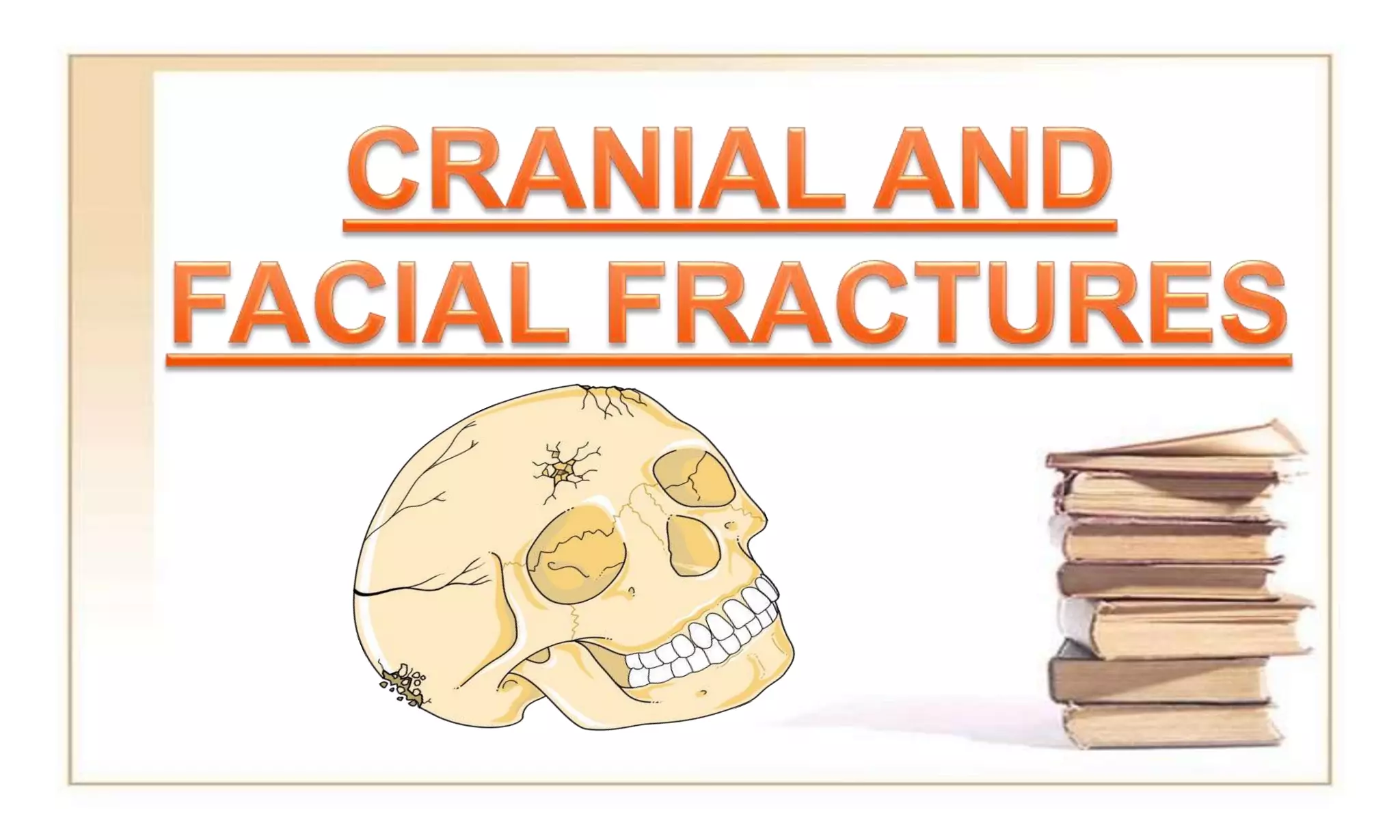 Cranial And Facial Fractures Ppt