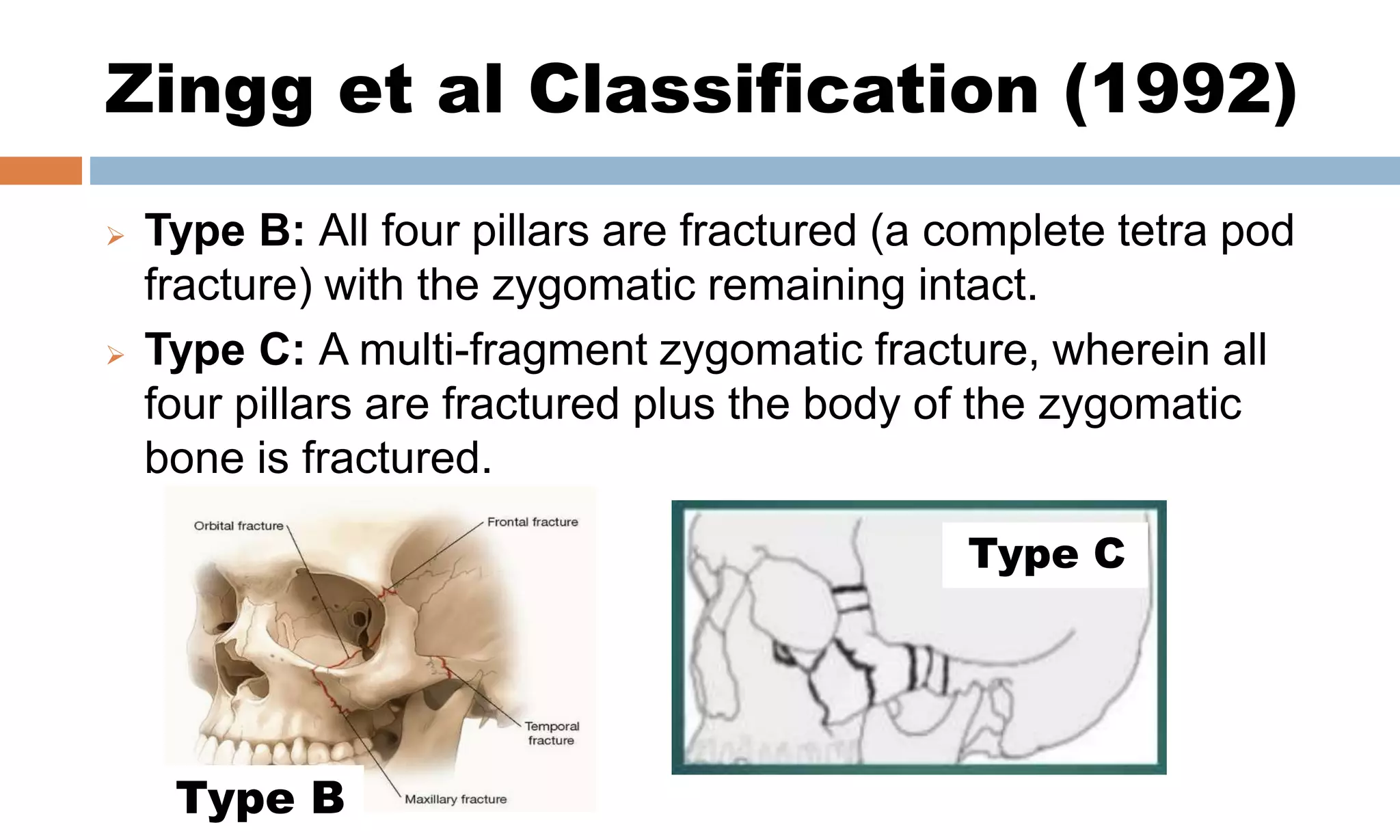 Cranial and facial fractures | PPTX