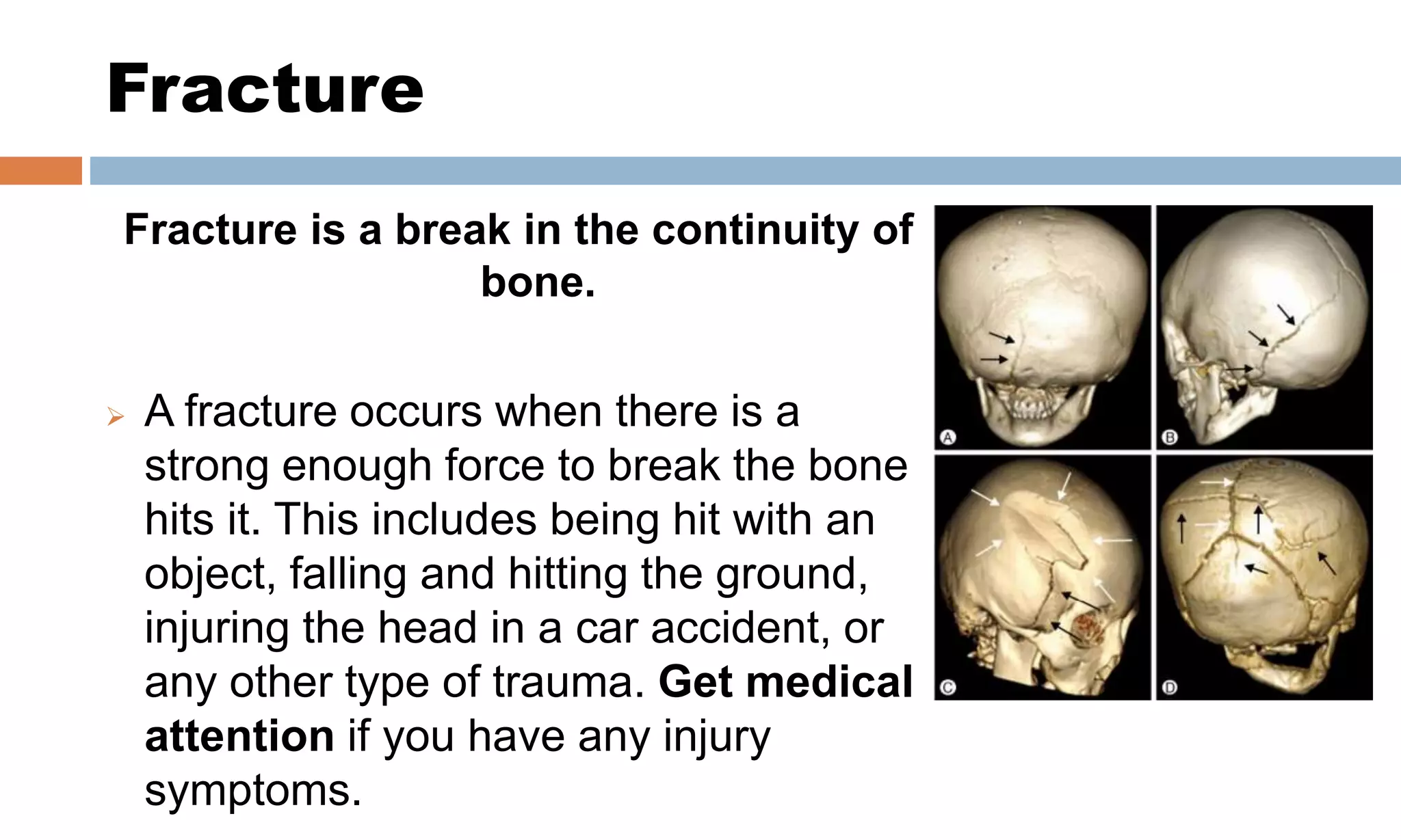Cranial and facial fractures | PPTX