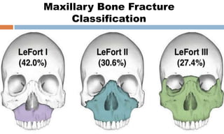 Cranial and facial fractures | PPTX