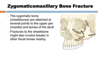 Cranial and facial fractures | PPTX
