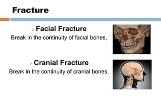 Cranial and facial fractures | PPTX