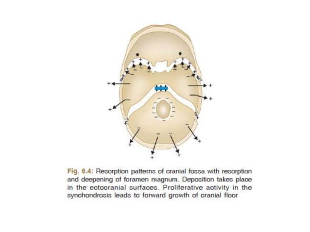 Cranial base angle in relation to malocclusion | PPTX