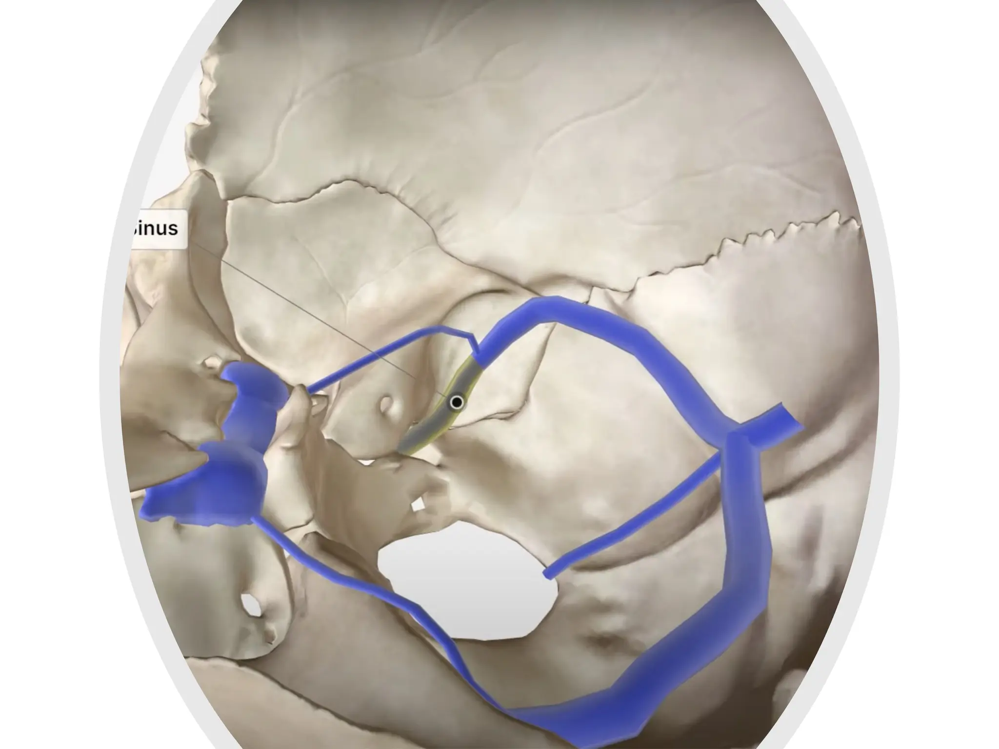 Cranial cavity Meninges and the dural sinuses.pptx