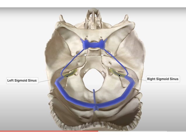 Cranial cavity Meninges and the dural sinuses.pptx