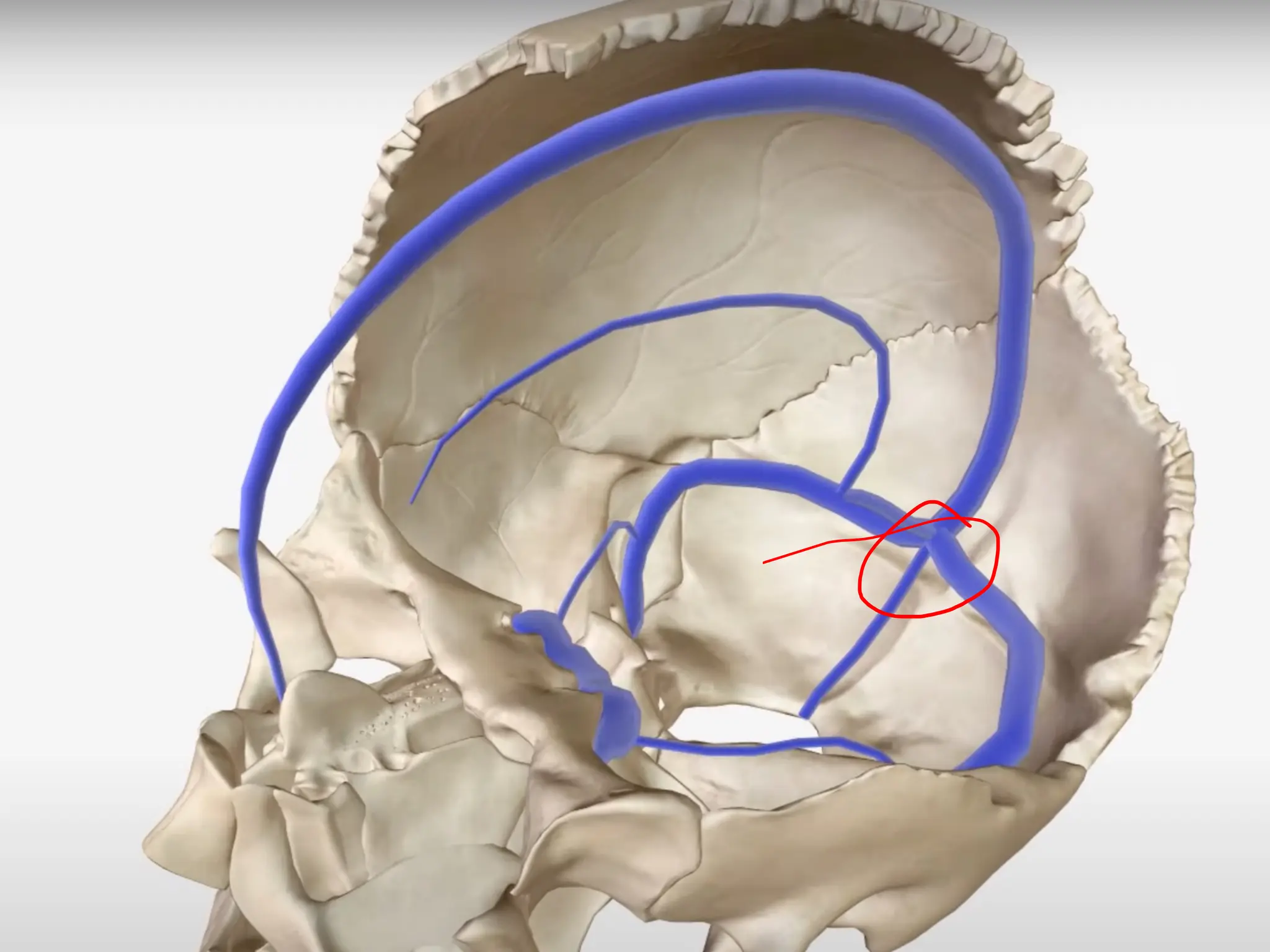 Cranial cavity Meninges and the dural sinuses.pdf